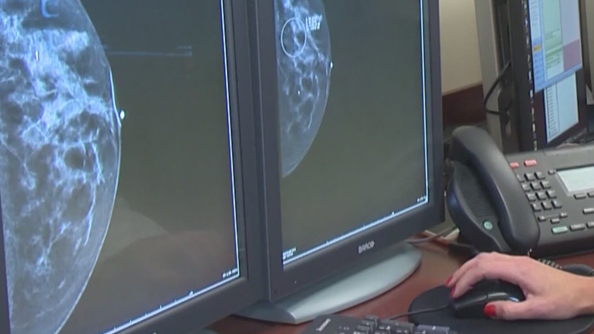 Free breast cancer screenings in Pasco County | wtsp.com