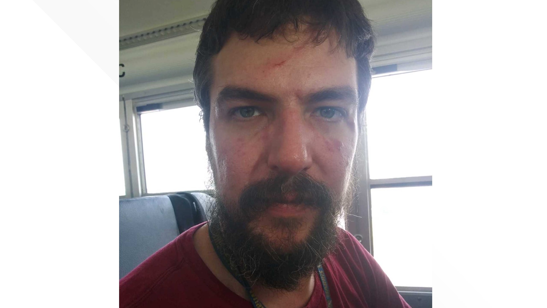 Robert Phillips shares images of injuries he says were caused by ...