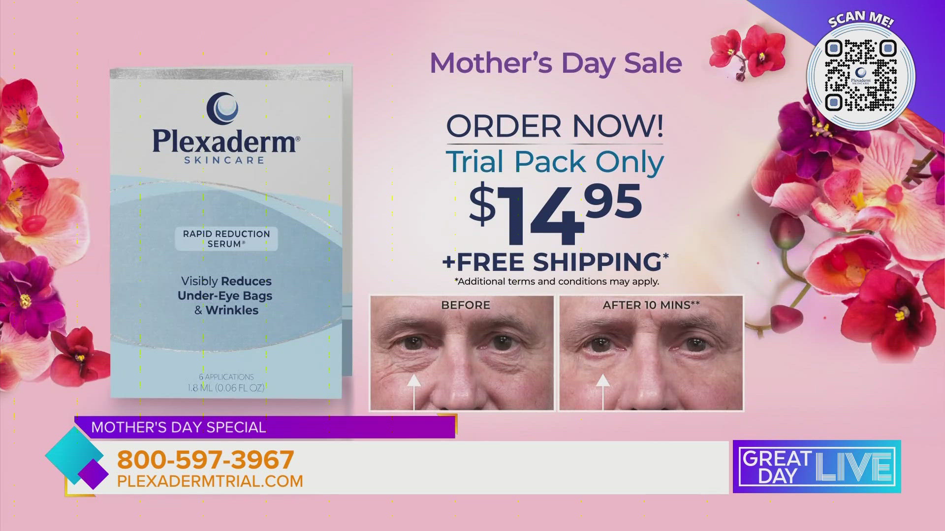 Plexaderm can help erase the lines of aging this Mother’s Day | wtsp.com