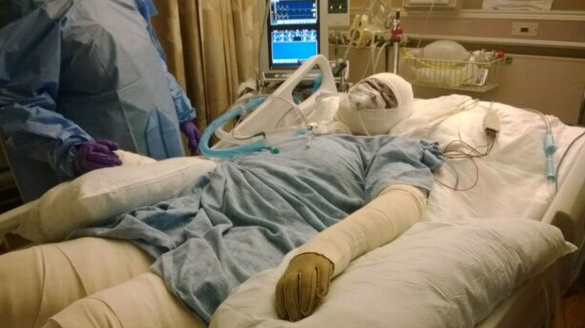 Woman's skin 'melts off' after medication error | wtsp.com