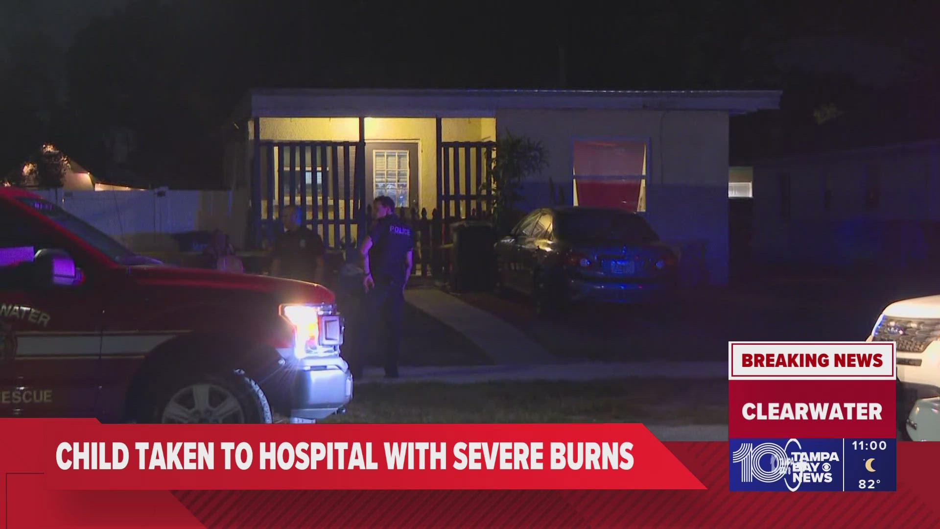 10-year-old seriously burned at Clearwater home | wtsp.com