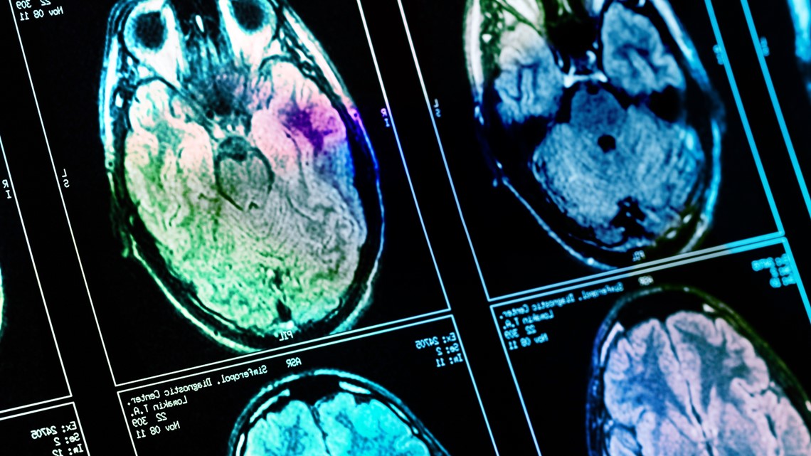 Study: Dying brain scan shows 'last recall' | wtsp.com