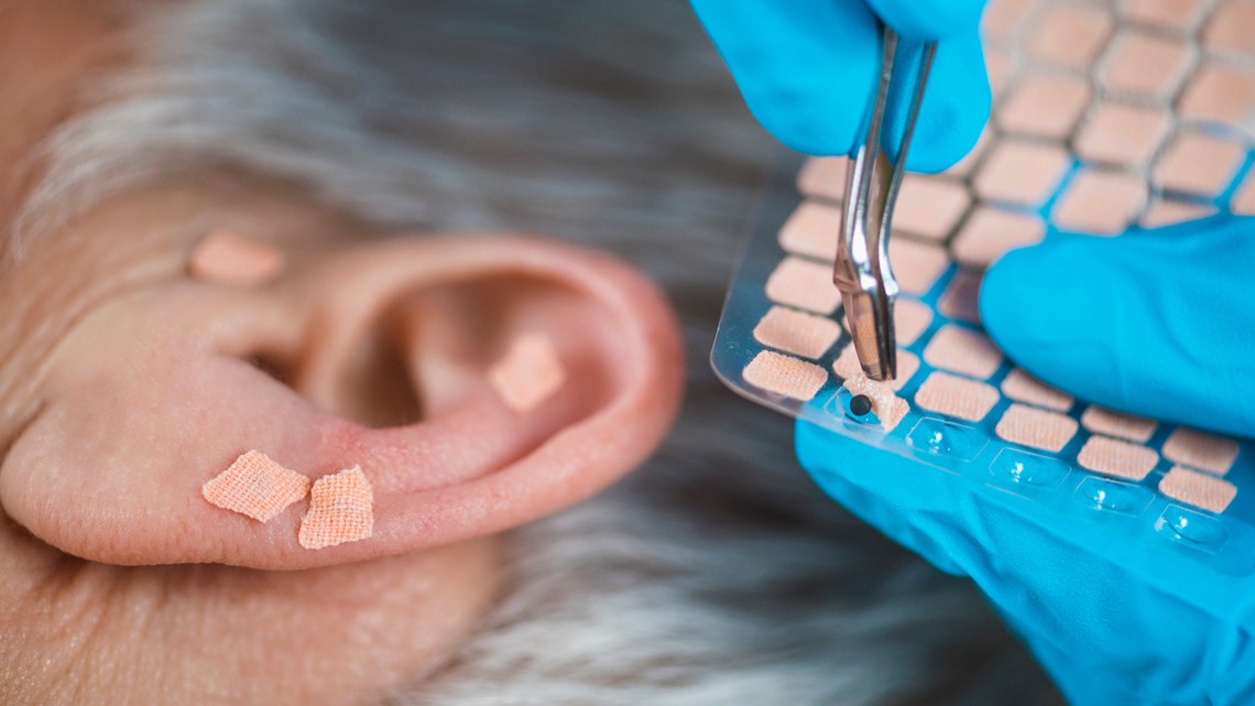 What is ear seeding and what are the health benefits? | wtsp.com
