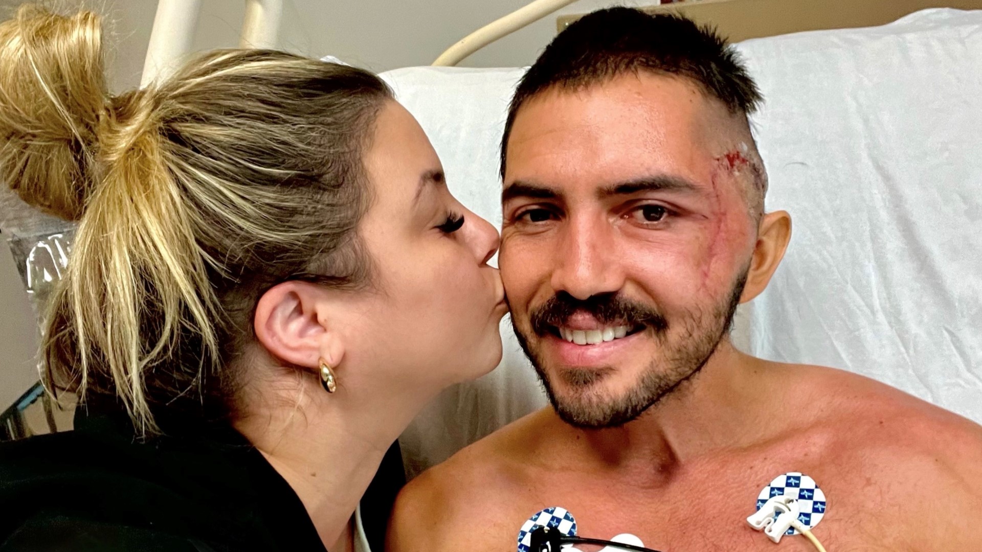 Florida man recounts alligator attack and his recovery journey | wtsp.com