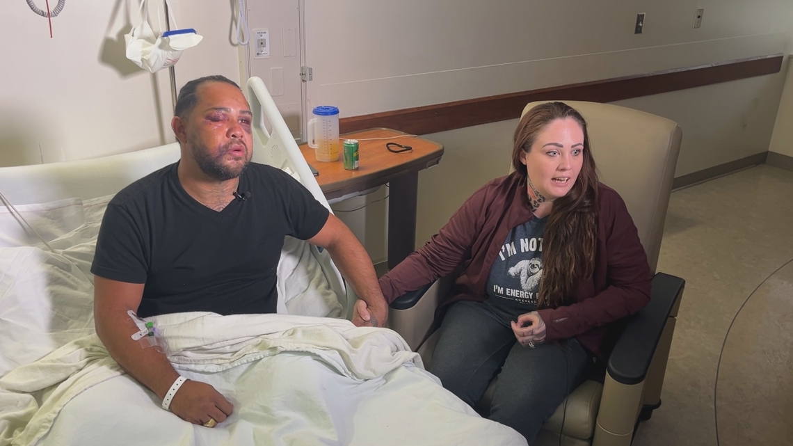 Florida woman accused of biting deputy after DUI arrest | wtsp.com