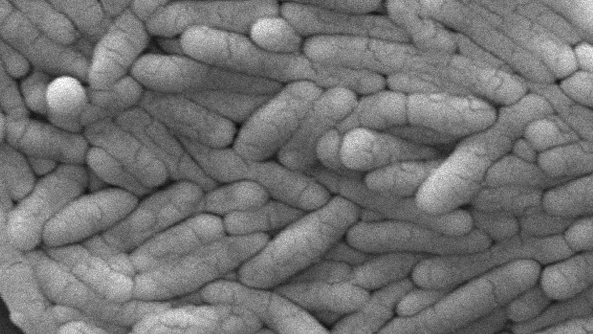 CDC reports case of drug-resistant Salmonella in Florida amid US ...