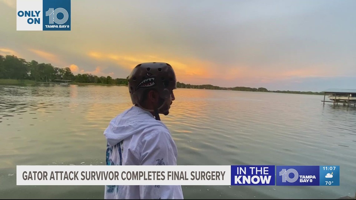 Tampa Bay triathlete completes final surgery after 'massive' gator ...