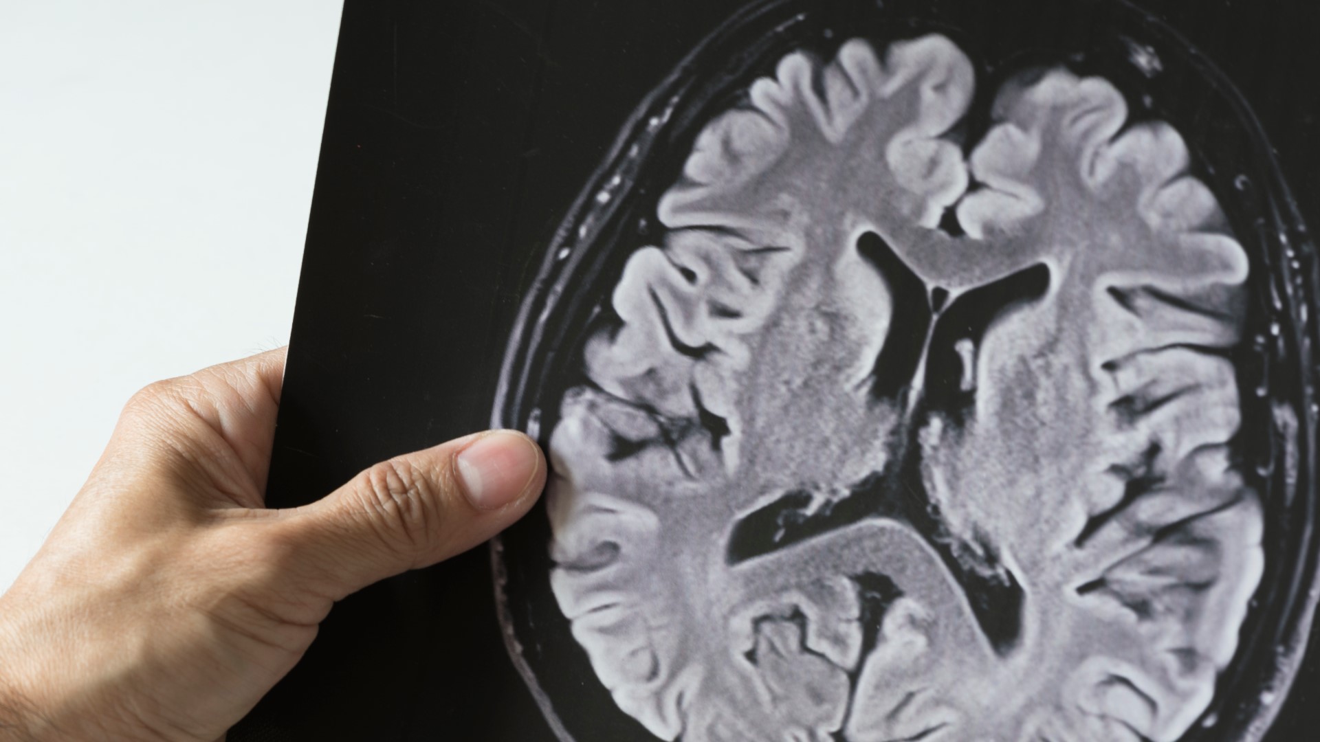 Harvard study: Thinking too much can lead to shorter life | wtsp.com