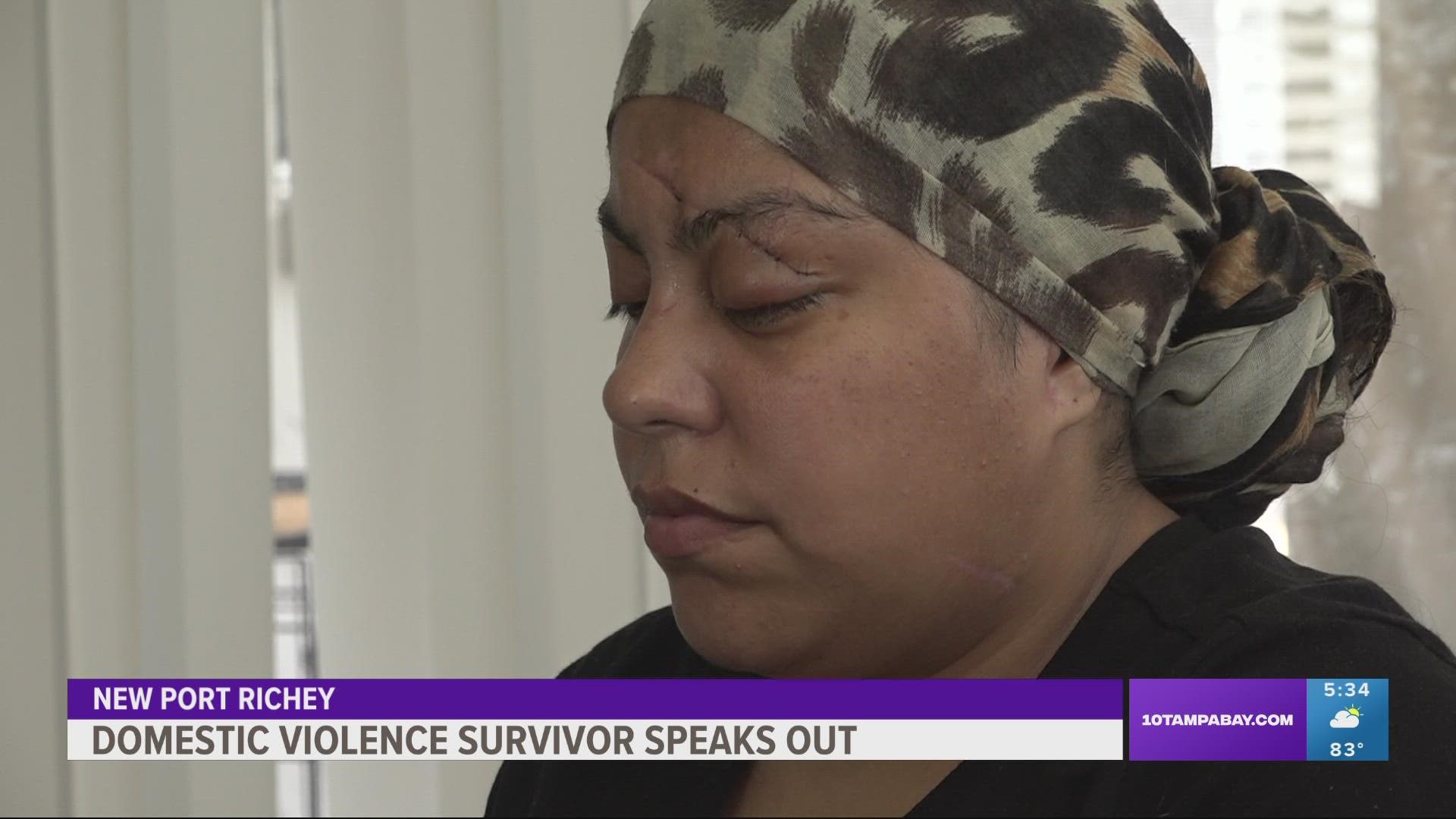New Port Richey woman shares story after being stabbed 37 times | wtsp.com