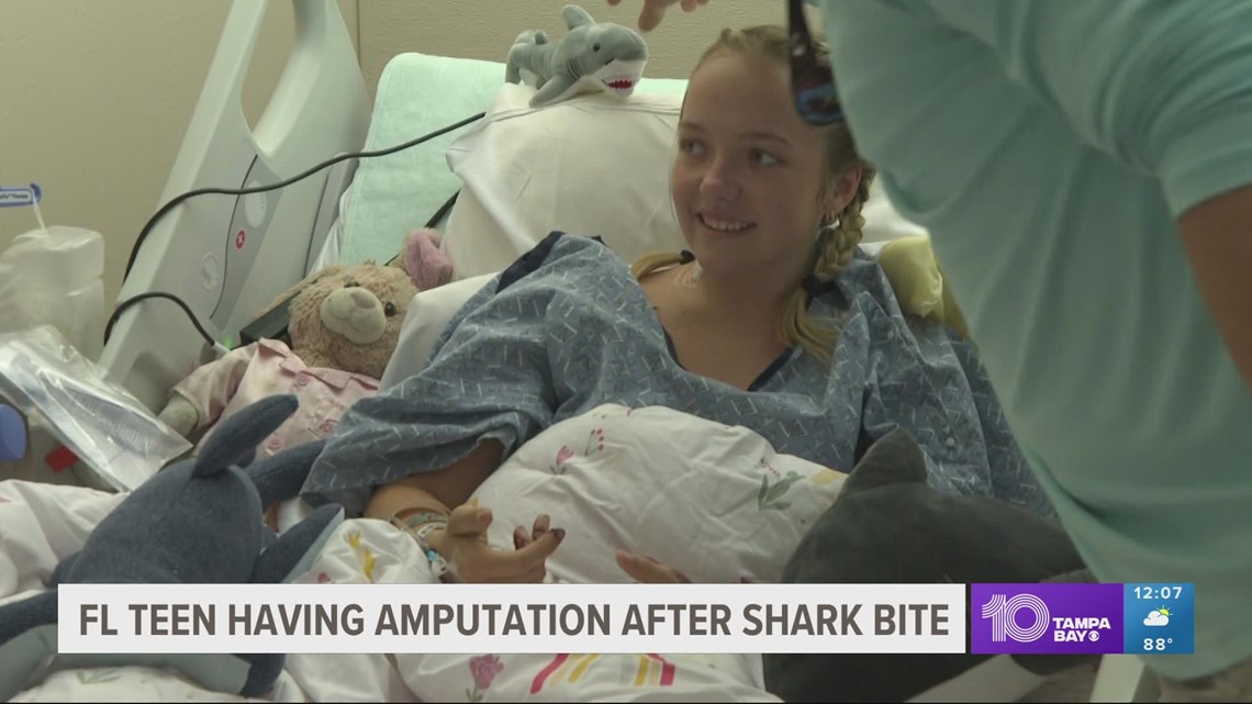 'She’s embracing it': Florida teen will have leg amputated after shark ...
