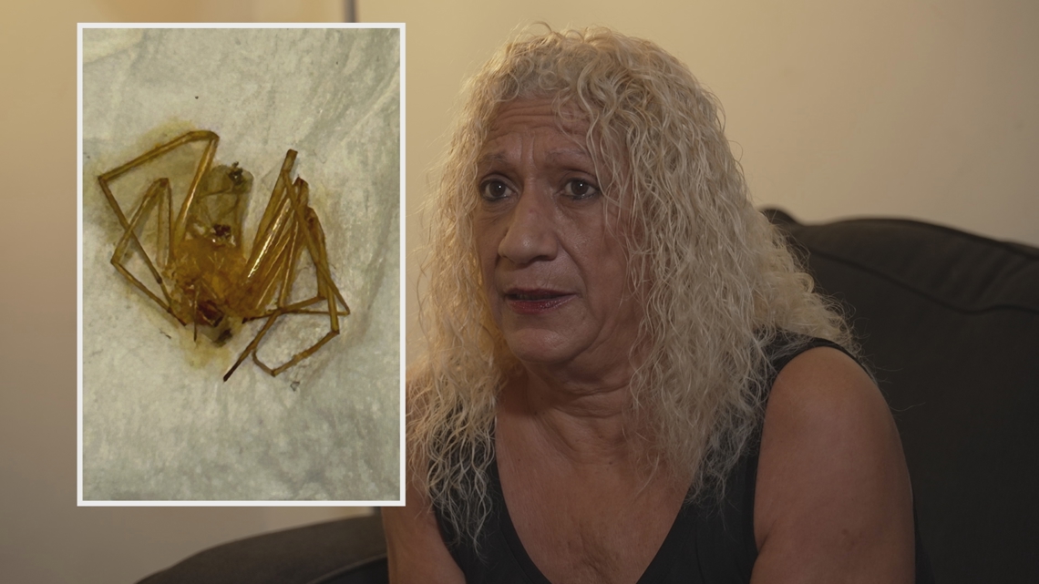 Woman sues Largo apartment management, claims spider bites led to toe ...