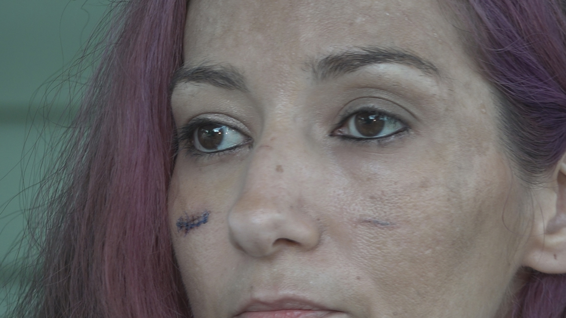 Victim of Pinellas Park home invasion shares her story of survival ...