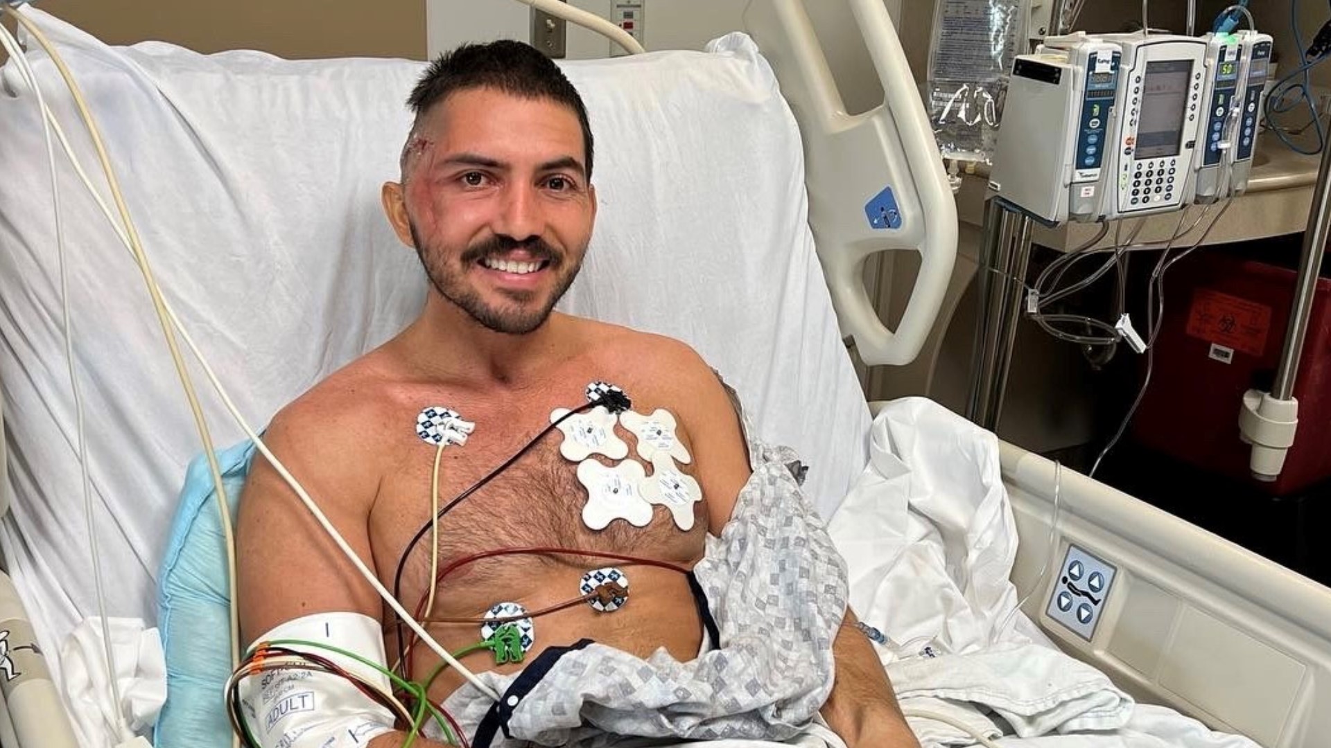 Strength & recovery: J.C. LaVerde's story after being attacked by an ...